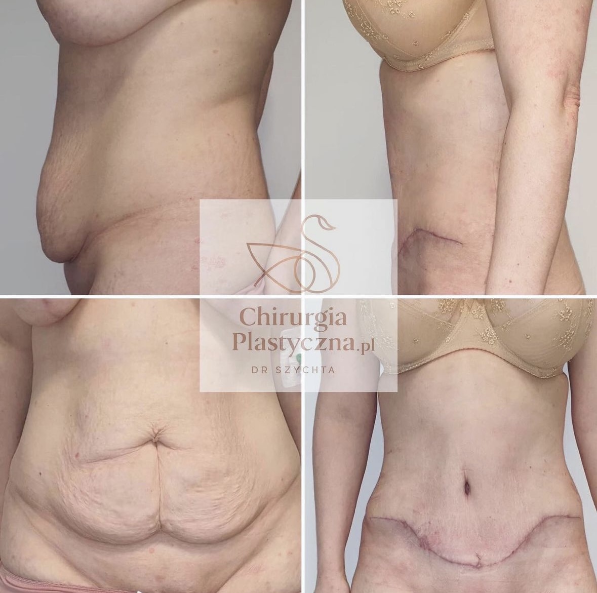 Chirurgia plastyczna